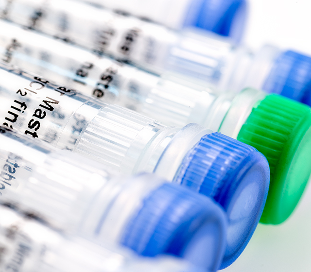 Endpoint PCR – PCR and qPCR | Eurogentec
