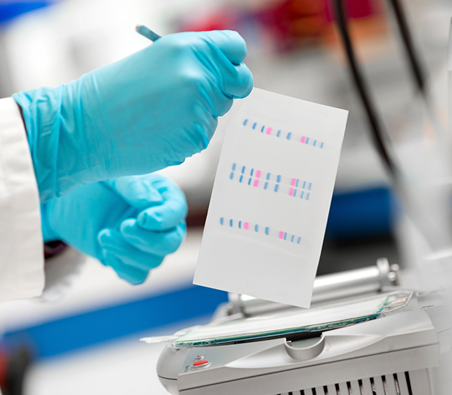 Custom Polyclonal Antibodies | Standard & Fast Production | Eurogentec