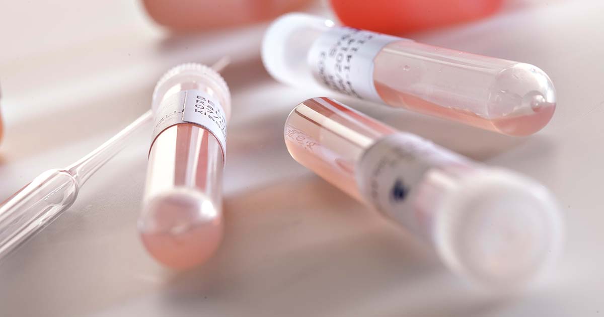 Custom Polyclonal Antibodies | Standard & Fast Production | Eurogentec