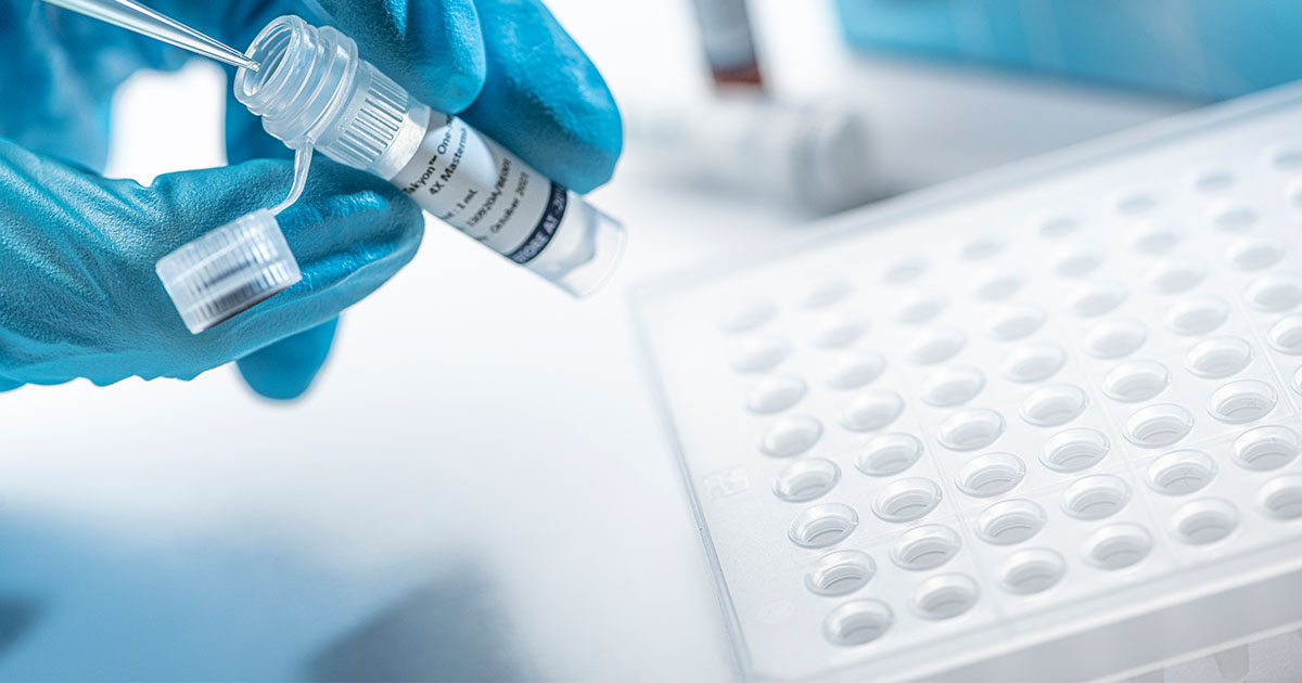Takyon® Ultra kits for qPCR & RT-qPCR | DNA & RNA detection