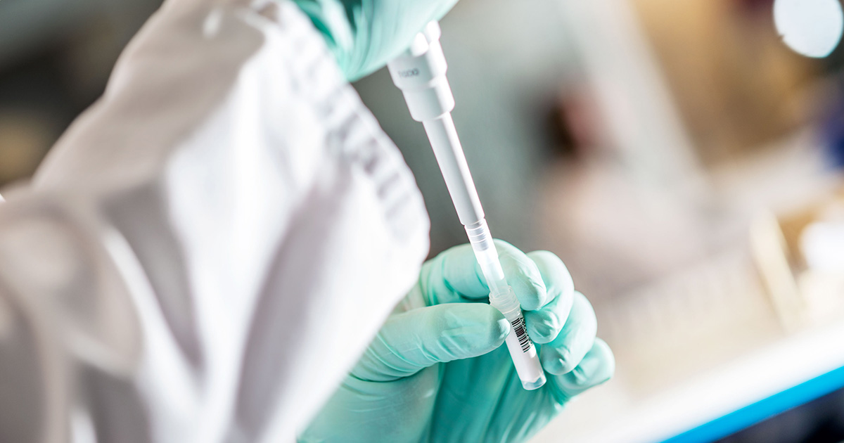 Custom antibodies – How to provide my antigen | Eurogentec